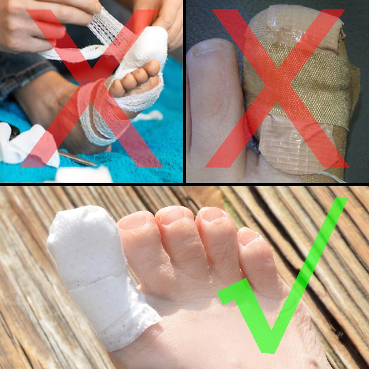 MediMitt ToeMitt Big Toe Bandages Non-Adhesive - Medium 10-Pack | Buy ...