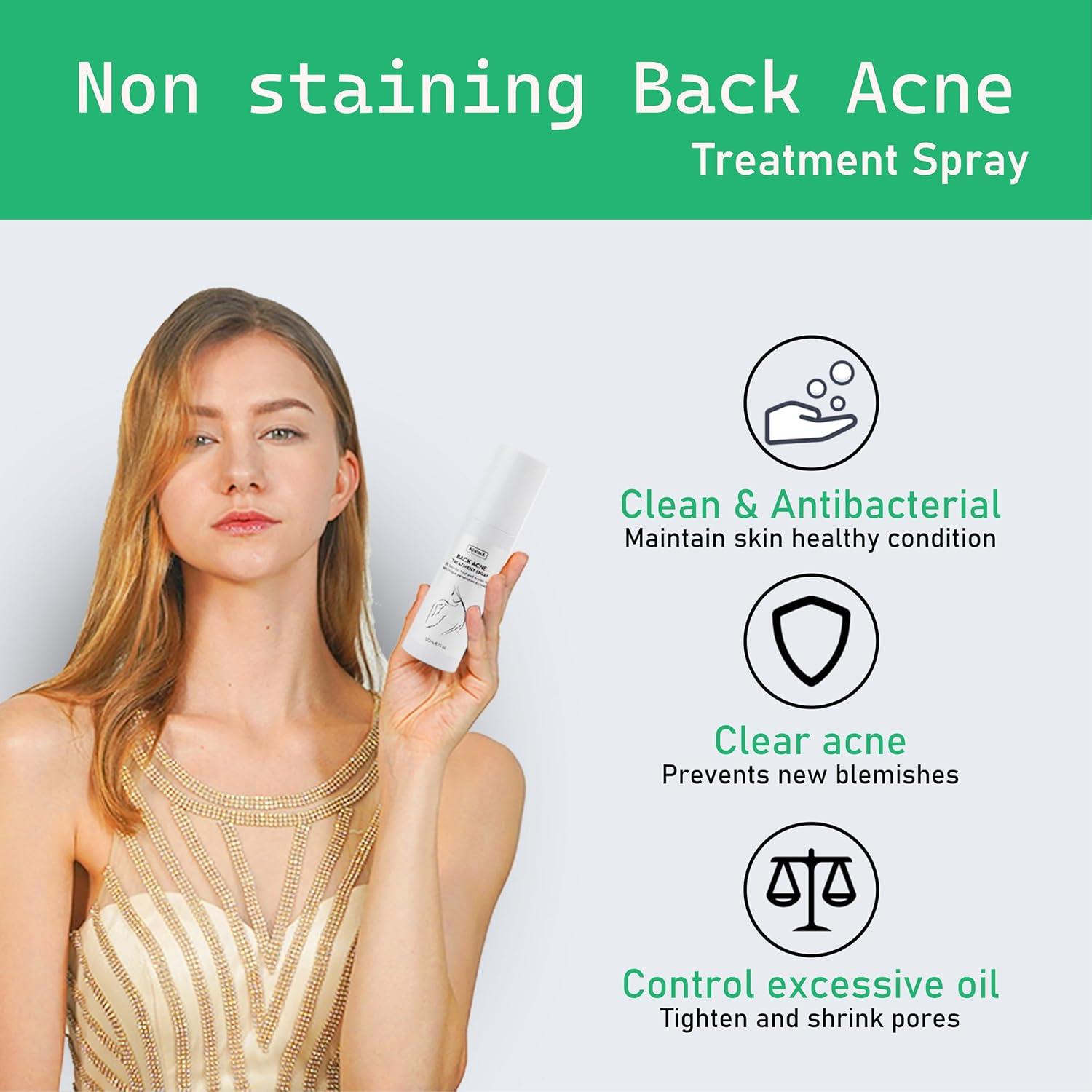 Back Acne Spray - 2% Salicylic Acid & Azelaic Acid Treatment for Body ...