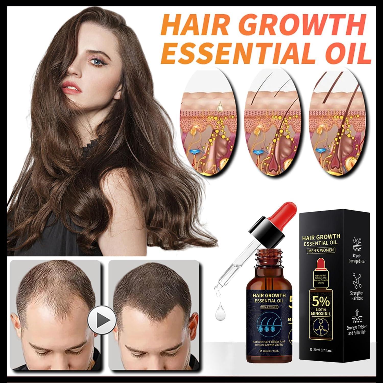 Natural Hair Growth Oil for All Hair Types - Nourishing Scalp Treatment ...