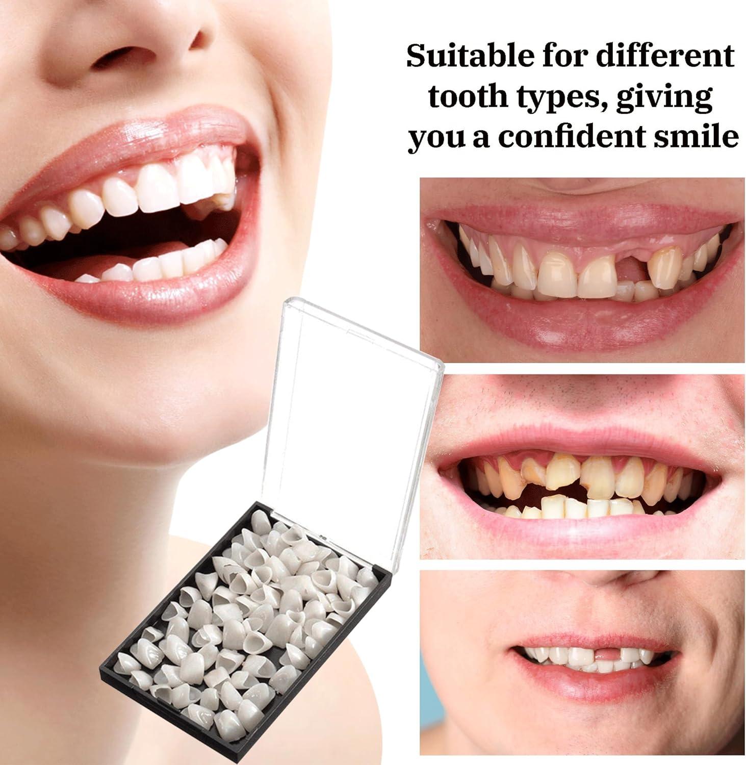 70PCS Temporary Tooth Crown Repair Kit - Durable Fake Teeth Cap for ...