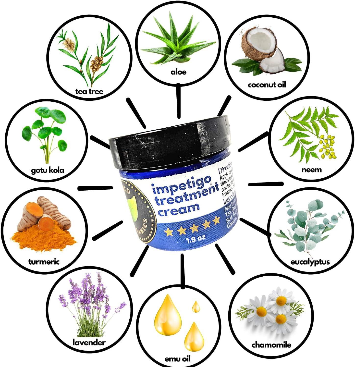 Tamed Organics Impetigo Symptom Relief Cream - Fast Acting Natural ...