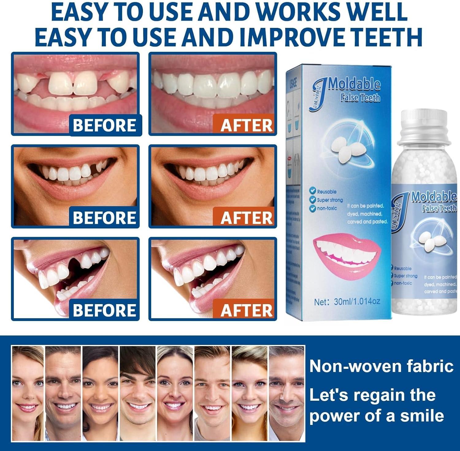 Dental Repair Kit - Temporary Tooth Filling Beads for DIY Fixing ...