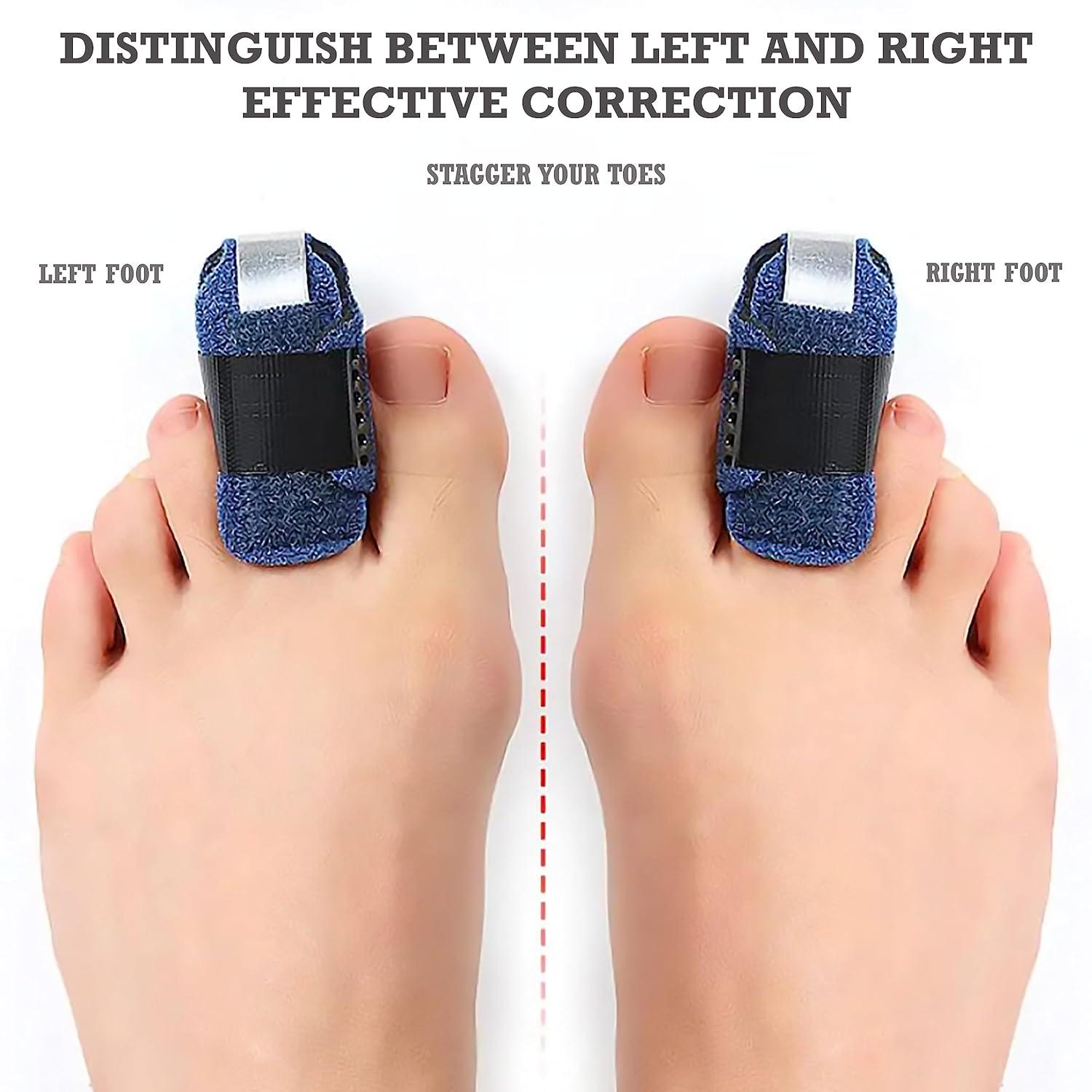 2 Pack Toe Straightener and Toe Brace for Hammer Toe - Blue | Buy Now ...