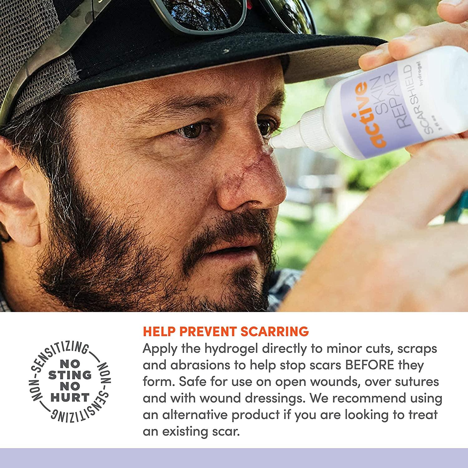 Active Skin Repair Scar Shield Hydrogel - Natural Scar Prevention Gel ...