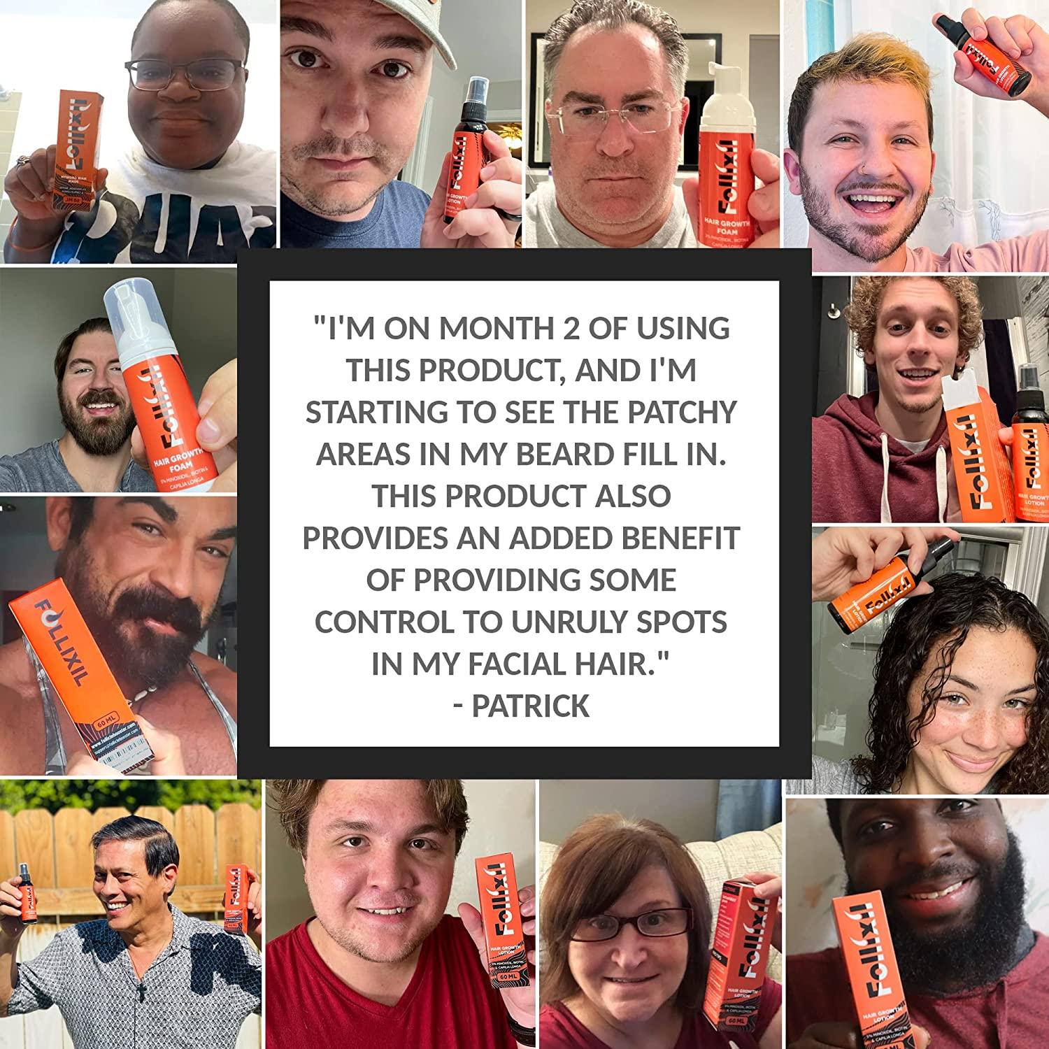 5% Minoxidil with Extra Biotin for Hair Growth - 1 Month Supply ...