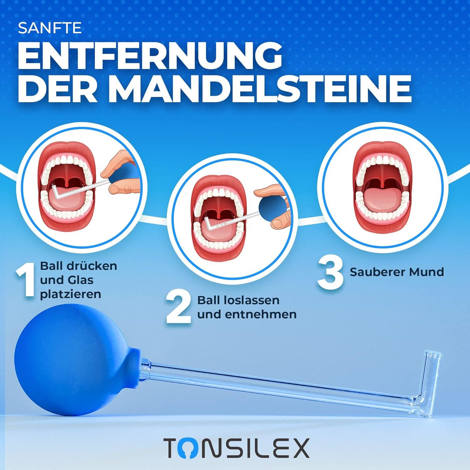 Tonsilex Almond Stones Cupping Glass | Remove Tonsil Stones ...