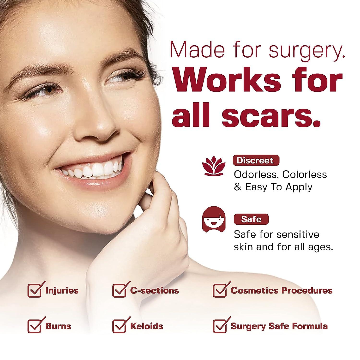 Medical Grade Silicone Scar Sheets for Surgery & Keloids - 5 Pack ...