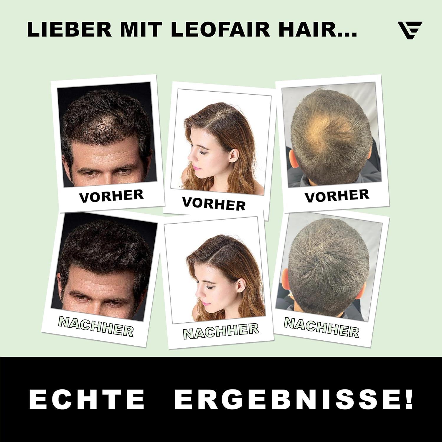 Leofair Hair Compression - 100% Natural Scatter Hair for Full & Dense ...