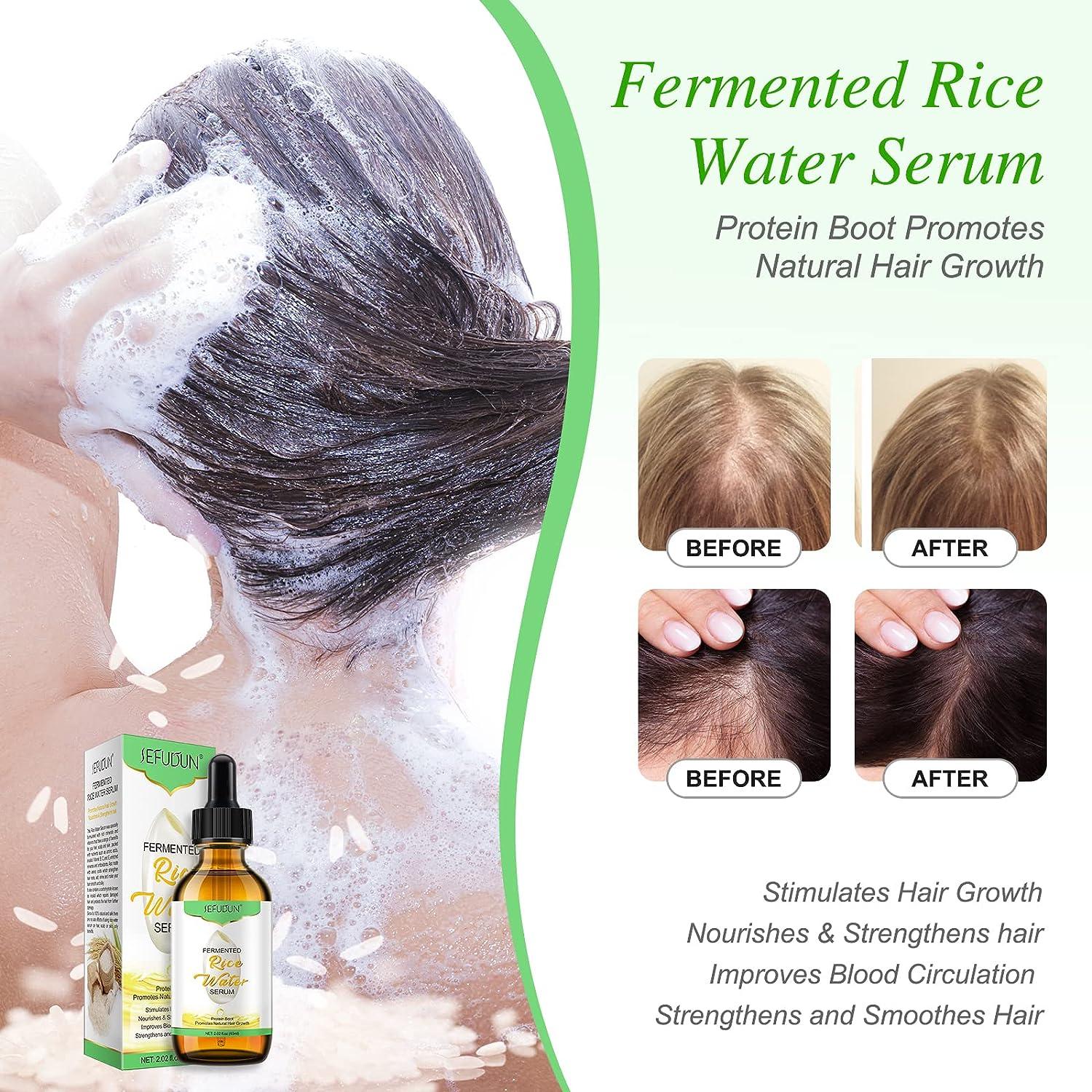 Rice Essential Oil for Hair Growth - 100% Pure Natural Serum for Thin ...