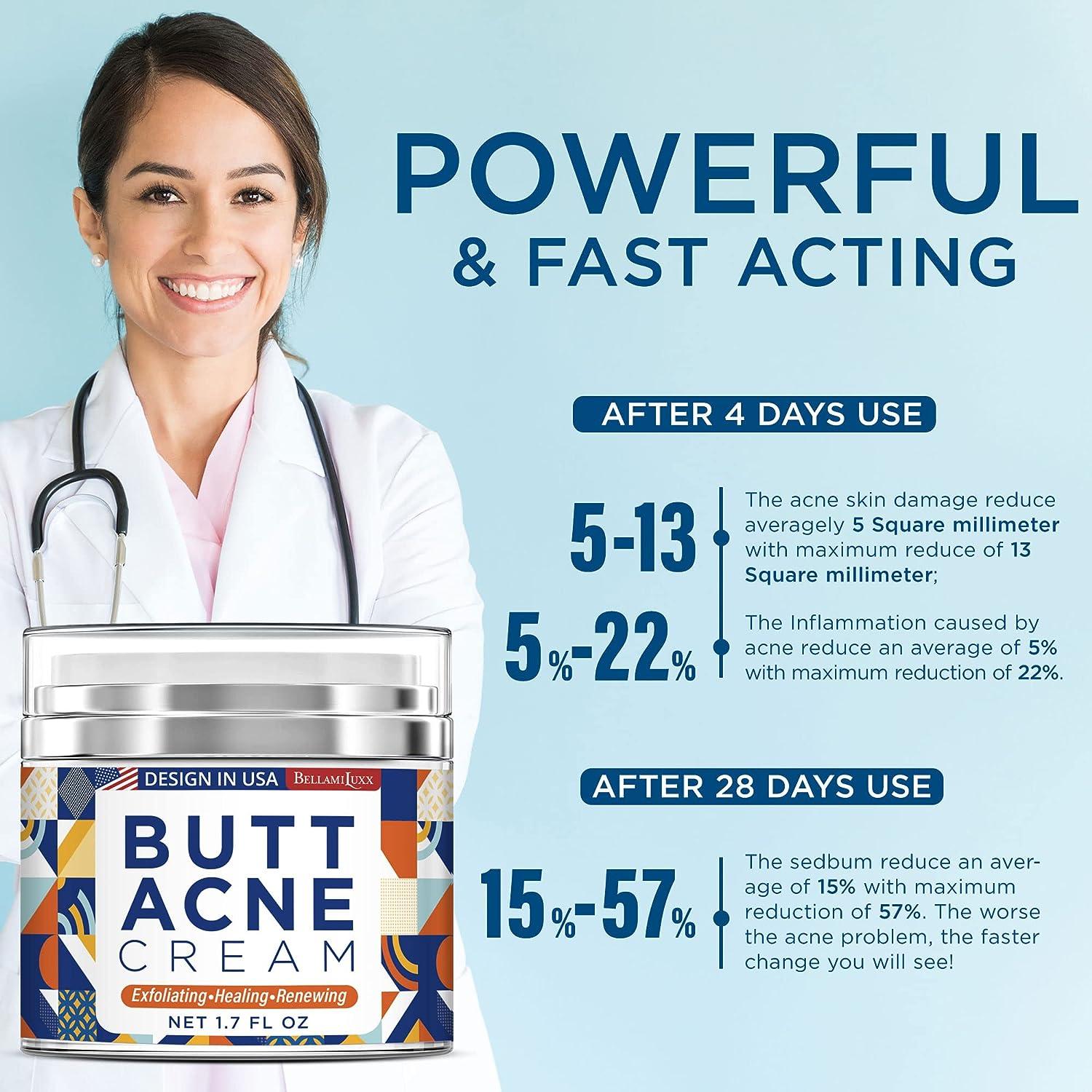 Acne Clearing Cream for Butt & Thigh - Moisturizing Exfoliating Formula ...