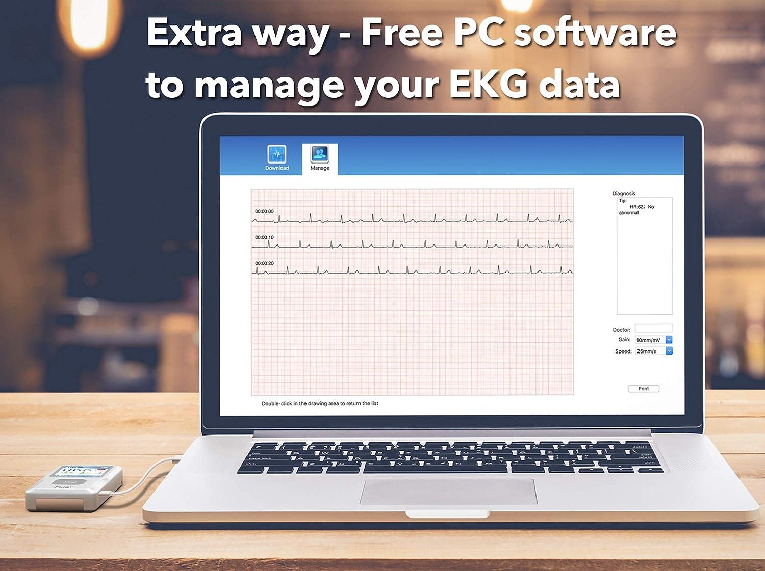 EMAY Portable EKG Monitoring Device | Personal Heart Monitor for iPhone ...