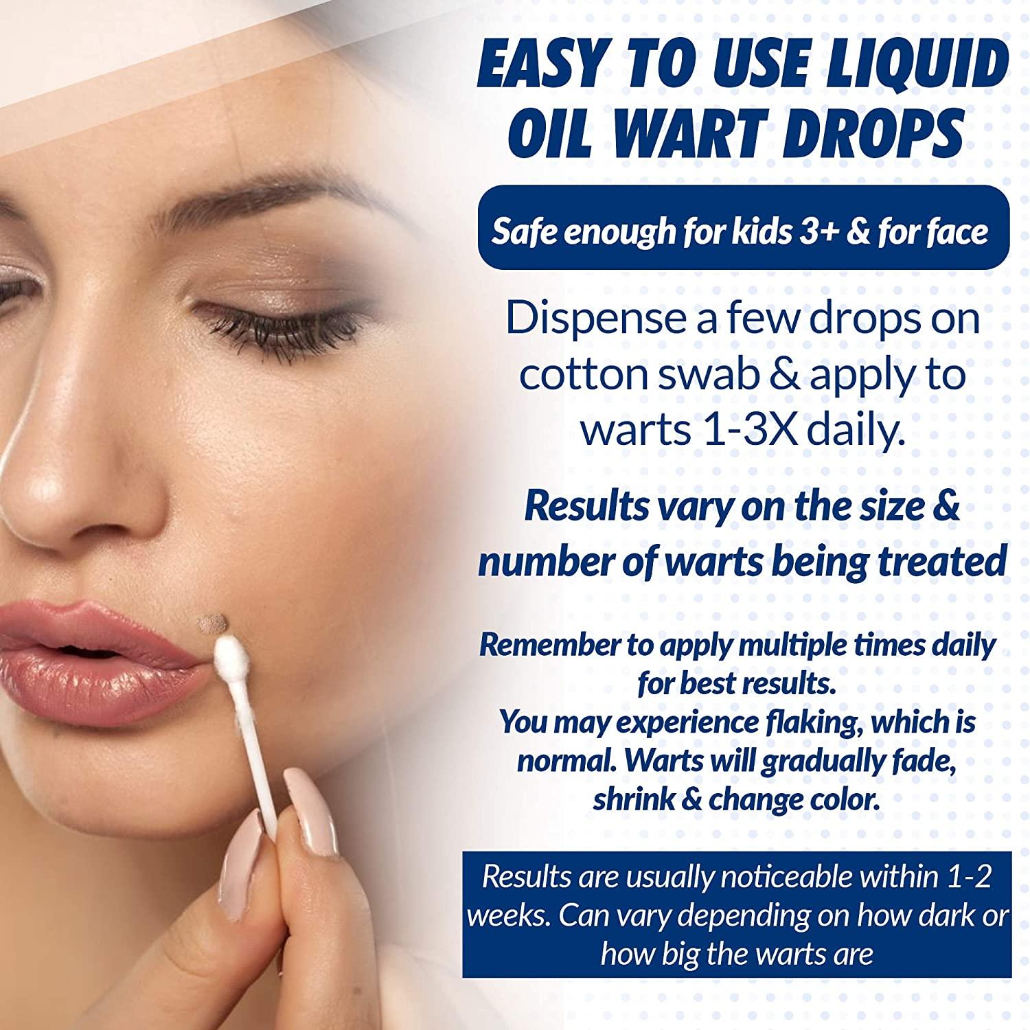 Warts On Face And Neck