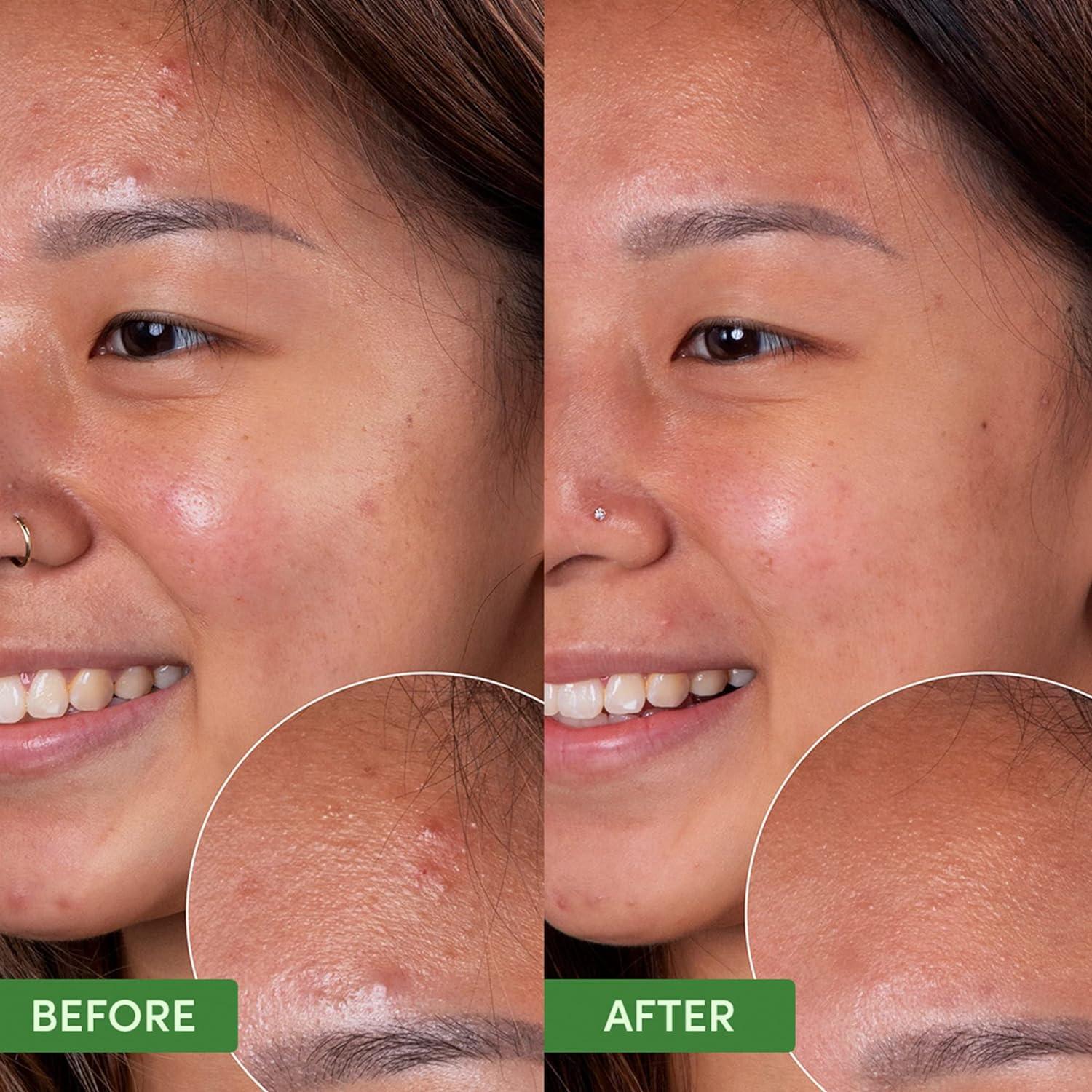 Sand & Sky Oil Control Clearing Cleanser | Gentle Daily Face Wash for ...