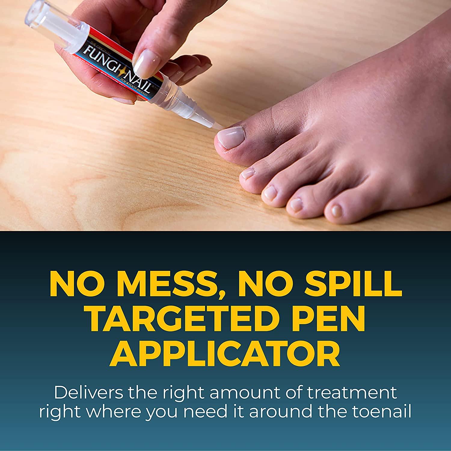 Fungi-Nail Pen Applicator Anti-Fungal Solution with Tolnaftate ...