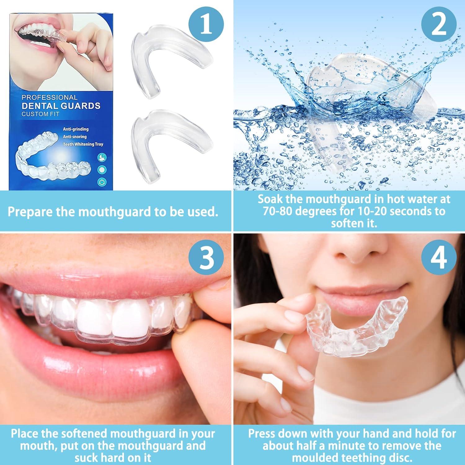 4-Piece Tooth Rail Crunch Set | Comfortable Nighttime Bite Protection ...