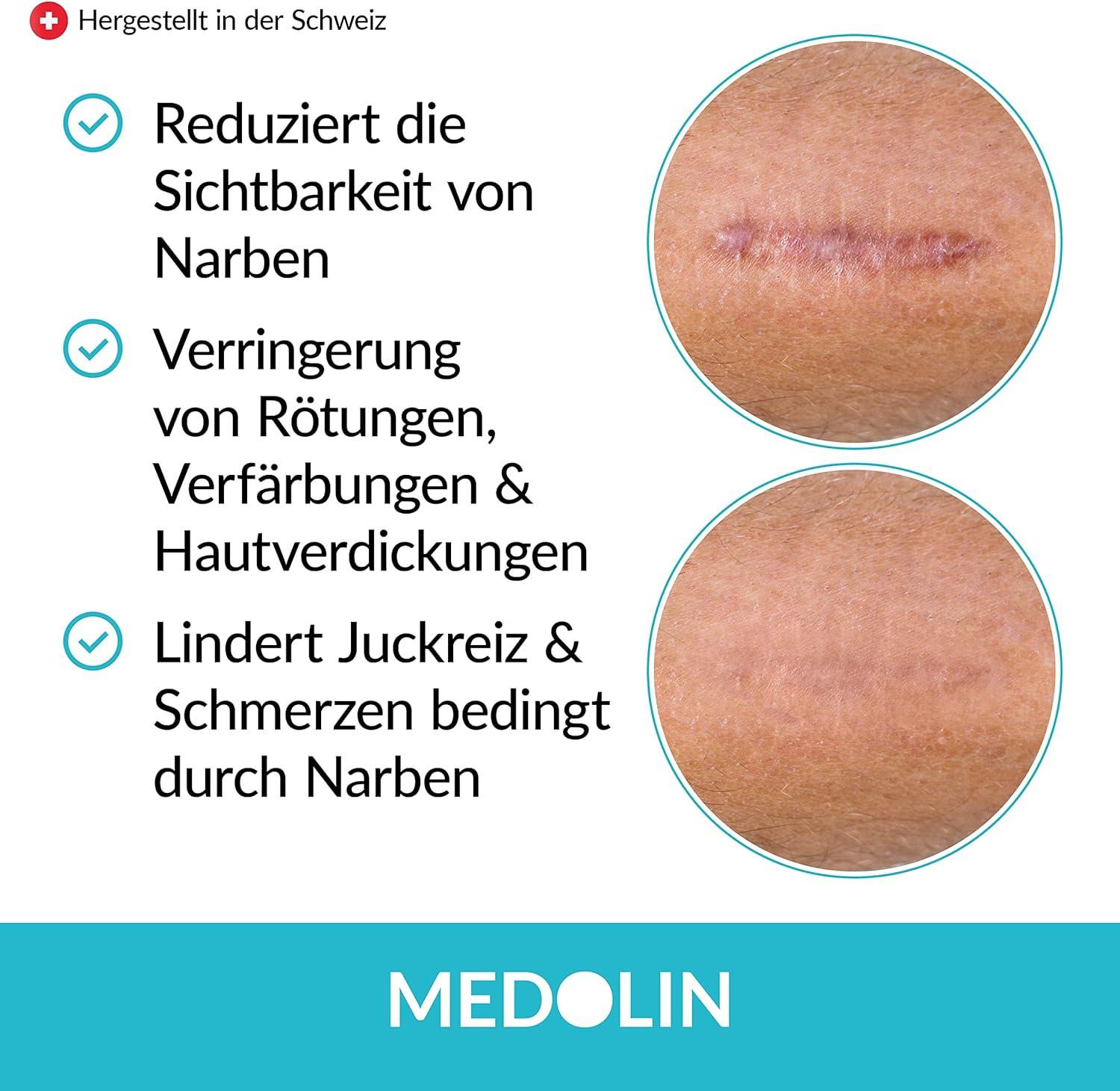 Medolin Scar Ointment - Reduce Scar Visibility | Certified EU Scar ...
