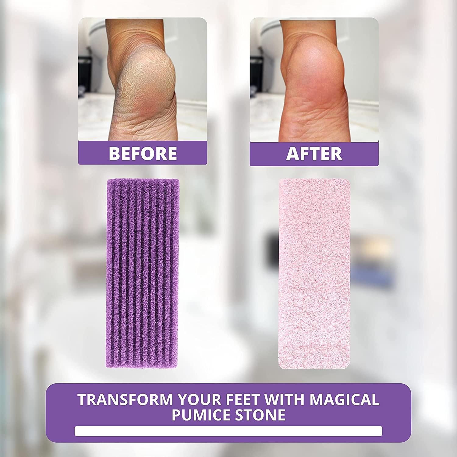 Purple Love Natural Pumice Stone - Professional Exfoliating Rock for ...