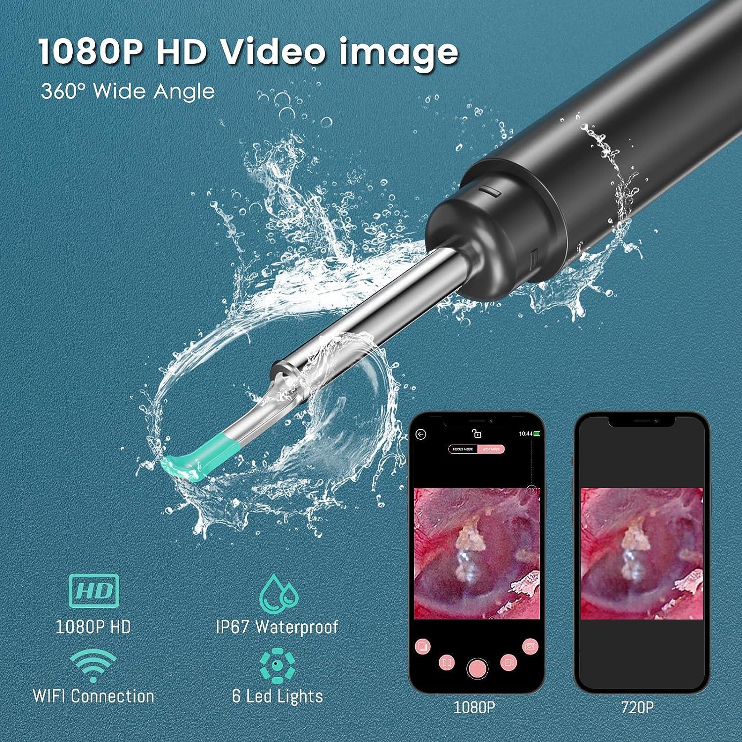 Wireless Otoscope Ear Wax Removal Kit with 1080P Camera - iPhone/iPad ...