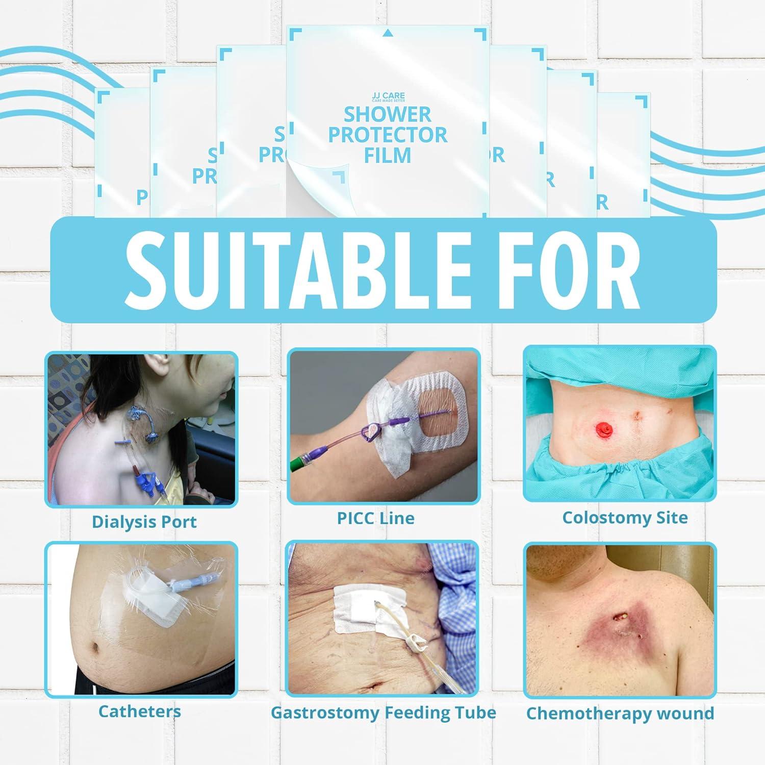 Veba Meditemp CAPD Bag Warmer Manual Secureway Peritoneal Dialysis PD ...