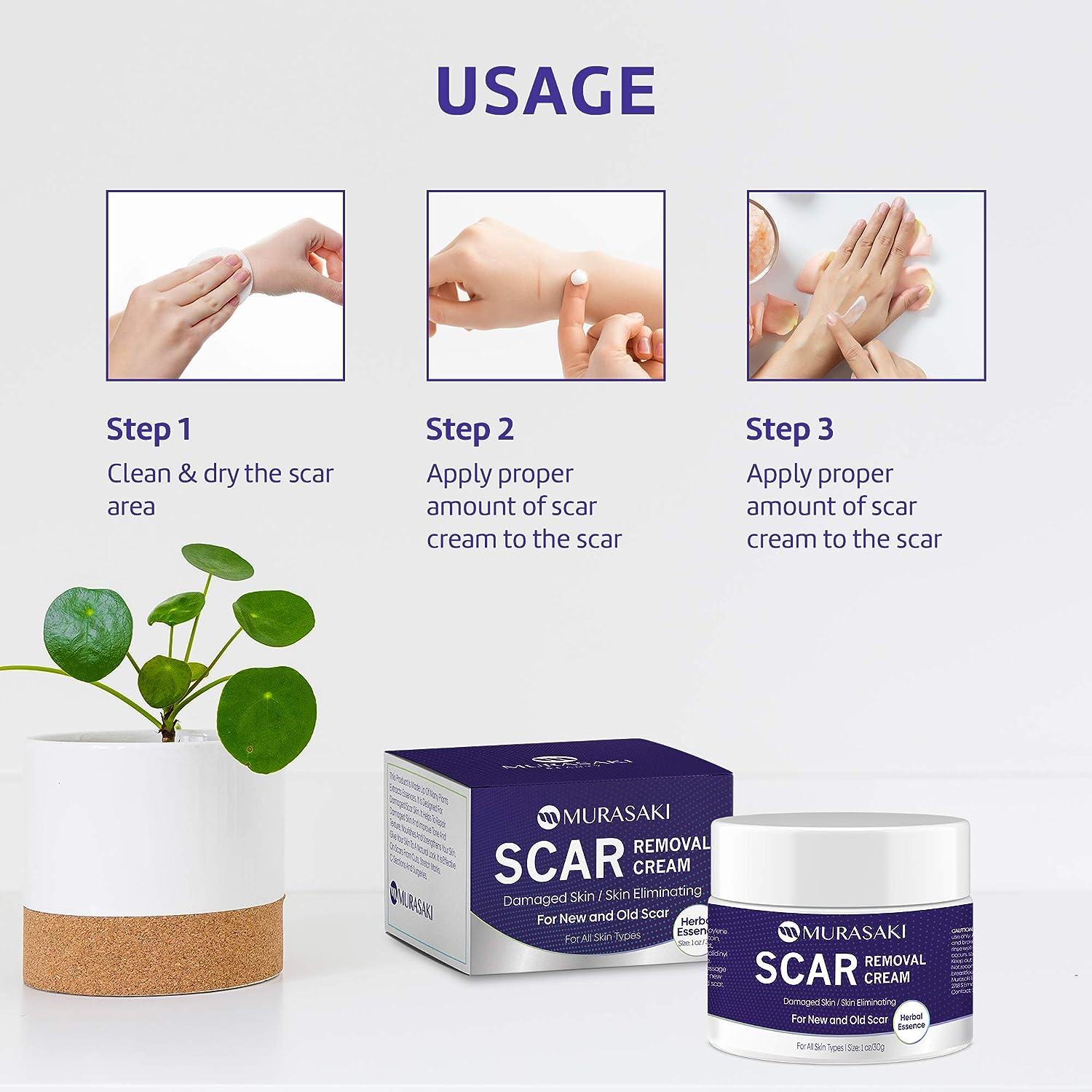 MURASAKI BEAUTY Scar Cream - Stretch Mark & Scar Removal Treatment - 1 ...