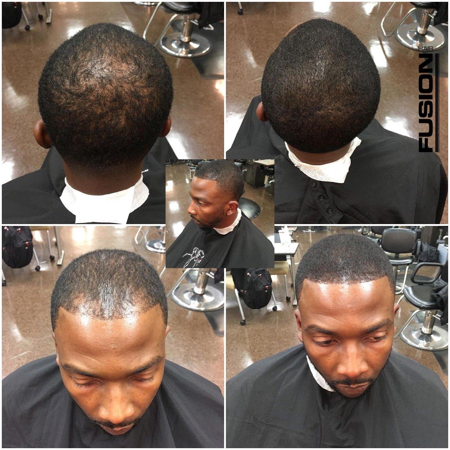 HAIR FUSION - Real Human Hair Fibers for Baldness & Thinning Hair ...