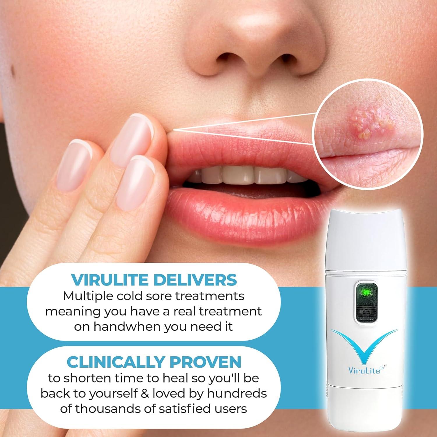 Virulite FDA Approved Cold Sore Treatment Device | Buy Now with Express ...