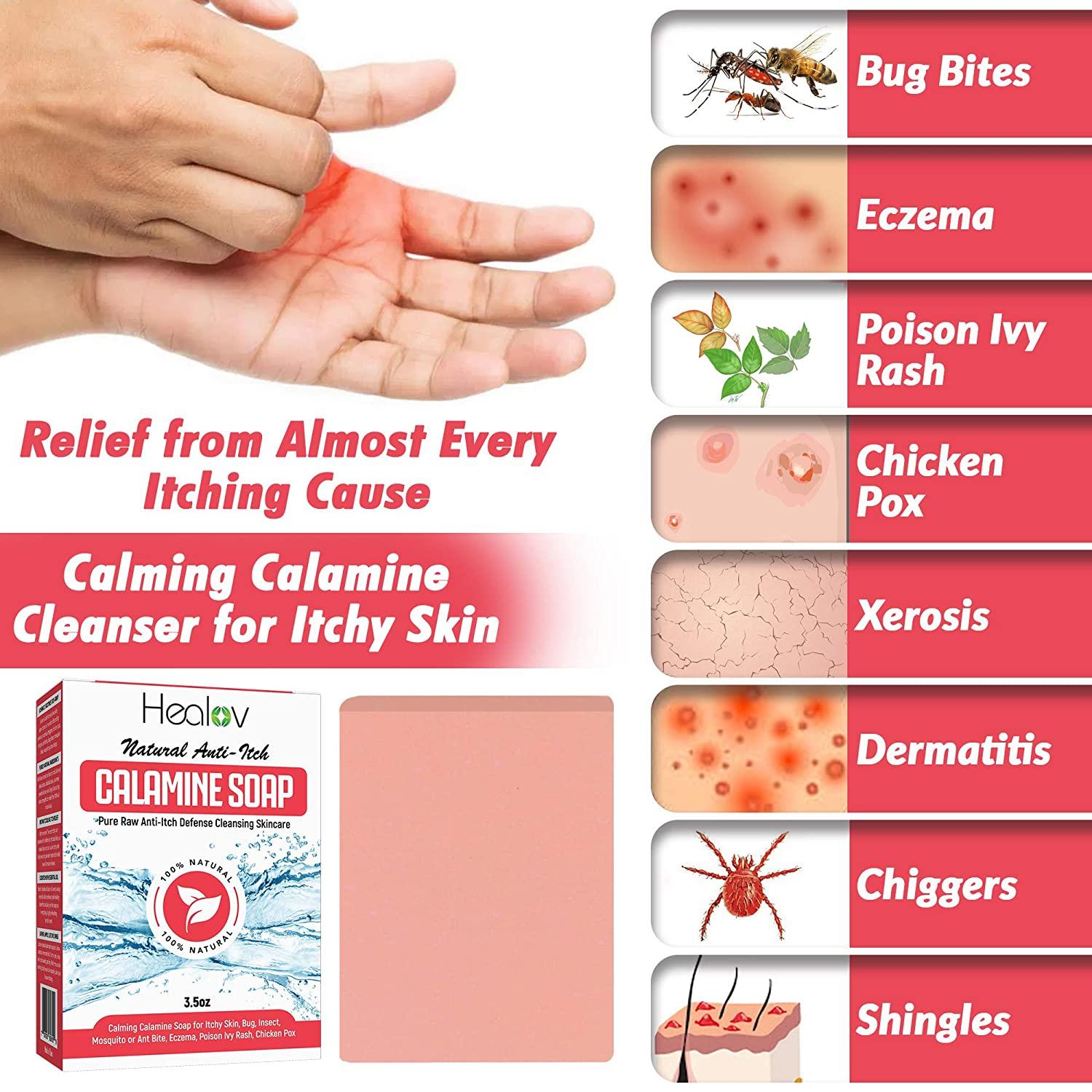 Calming Calamine Soap Bar for Instant Itch Relief - Ideal for Bug Bites ...