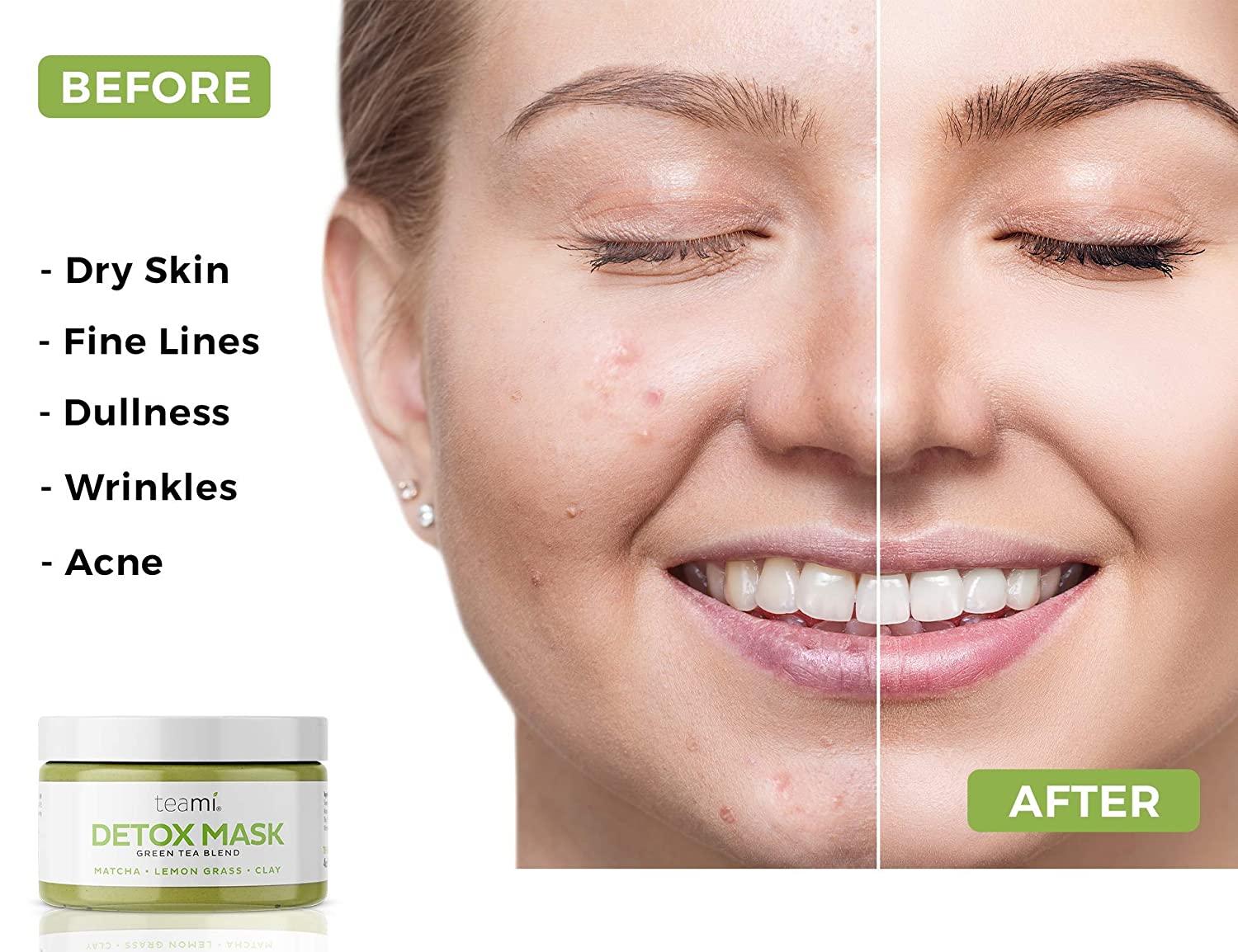 Teami Green Tea Detox Mask - Deep Cleansing Pore Minimizer & Blackhead ...
