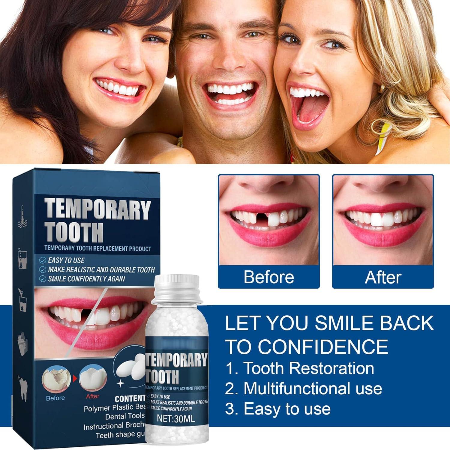 WTTFC Tooth Repair Granulate - Provisional Dentures & Temporary Tooth ...