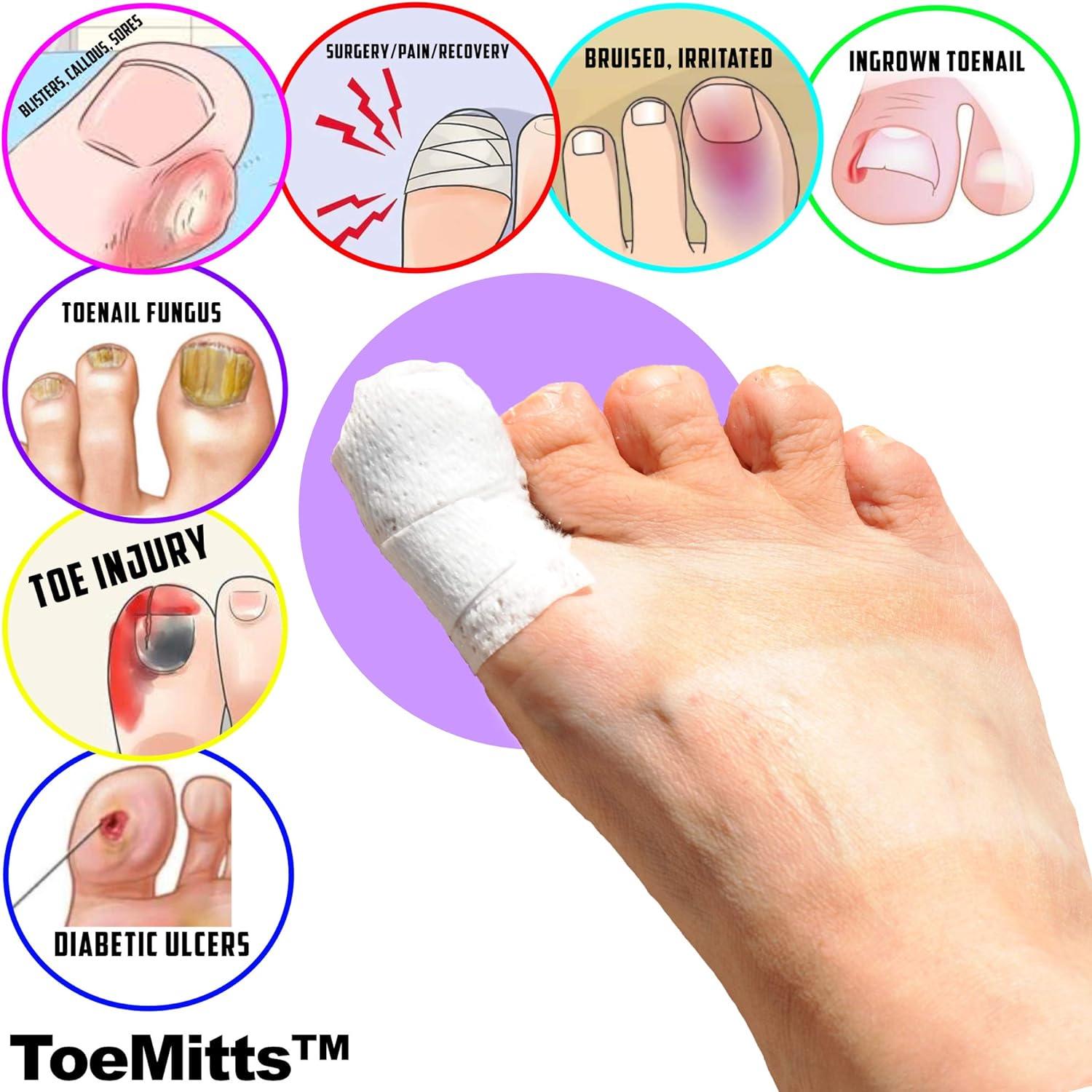 MediMitt ToeMitt Big Toe Bandages Non-Adhesive - Medium 10-Pack | Buy ...