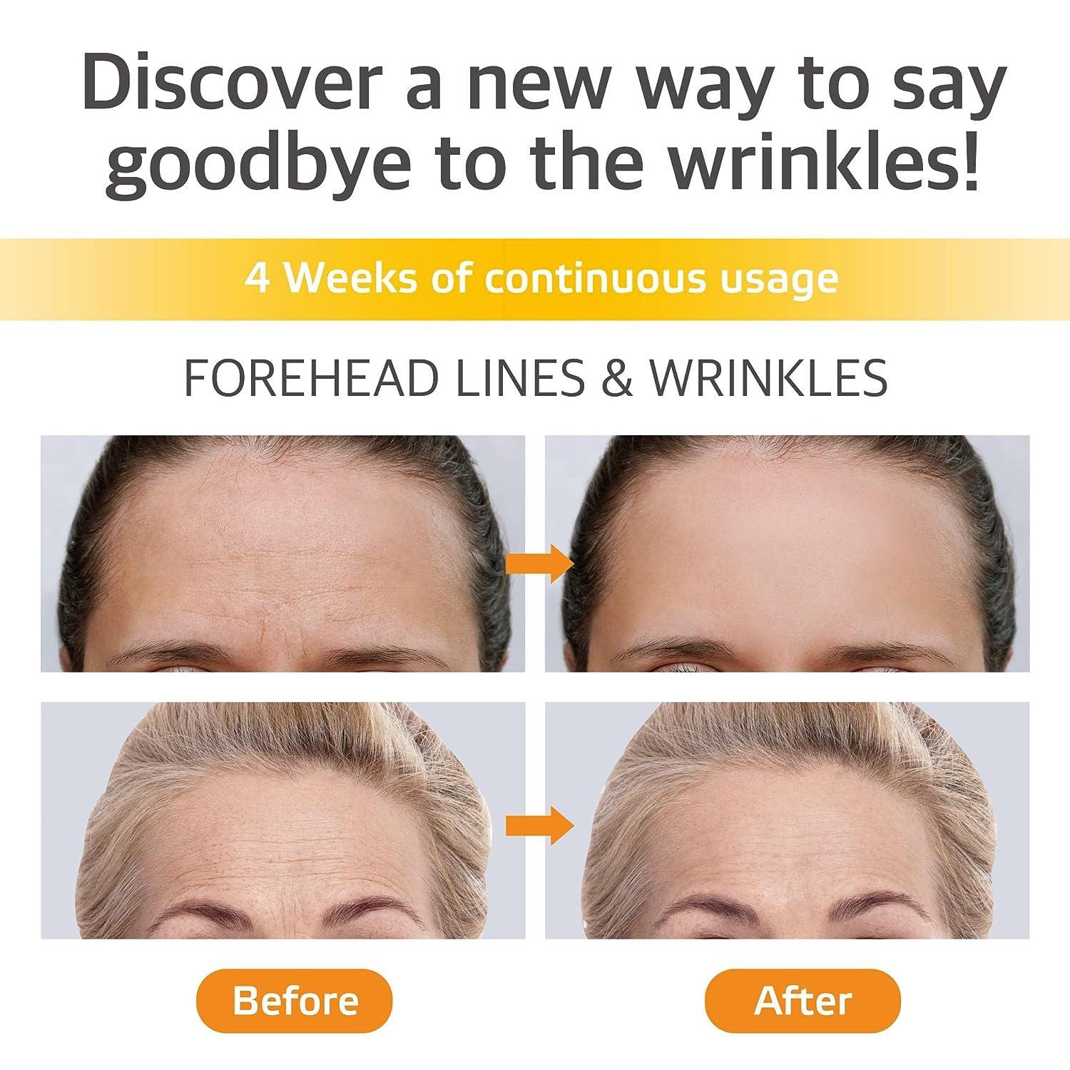 Labottach Forehead Wrinkle Patches - Anti Aging Face Lift & Chest Pads with Collagen, Hyaluronic ...