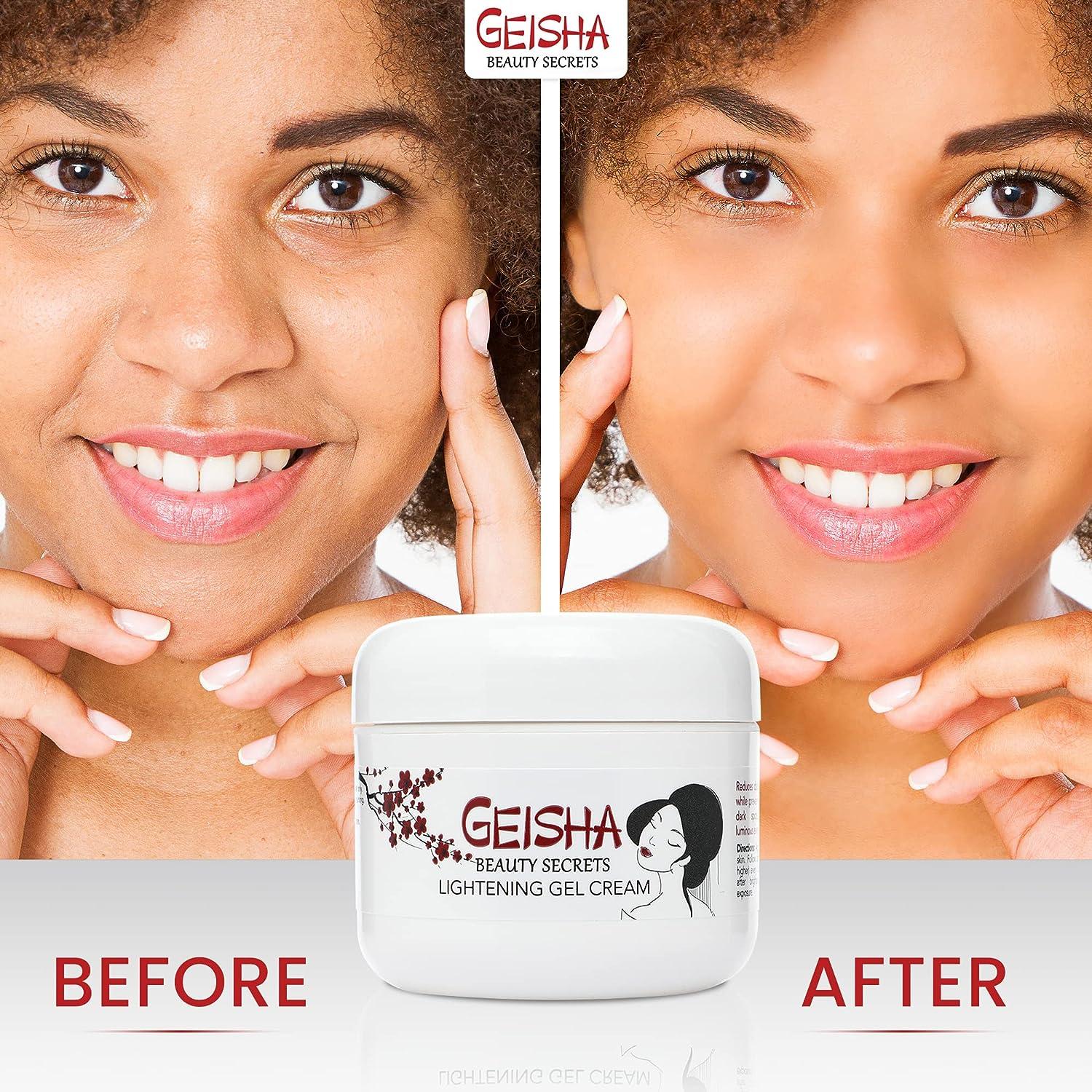 Geisha Kojic Acid Cream - 1.7 fl oz - Dark Spot Remover for Face, Body ...