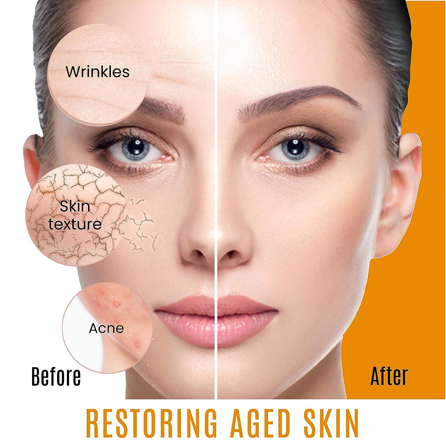 Dermaxgen Vitamin C Moisturizing Cream Organic Anti Aging Collagen Booster For Glowing
