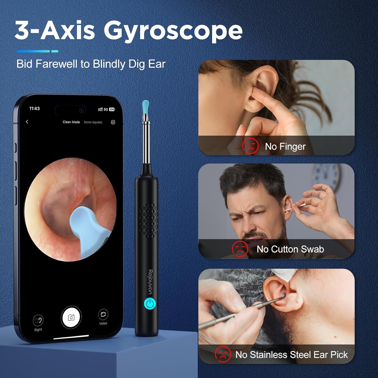 Wireless Ear Wax Removal Tool with 1080P HD Camera and 6 Lights ...