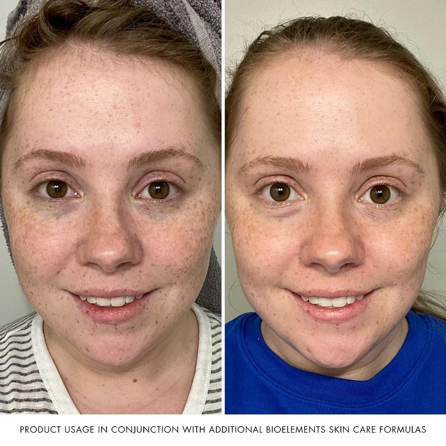 Bioelements Beyond Hydration Gel Moisturizer - 2.5 fl oz - Vitamin B5 ...