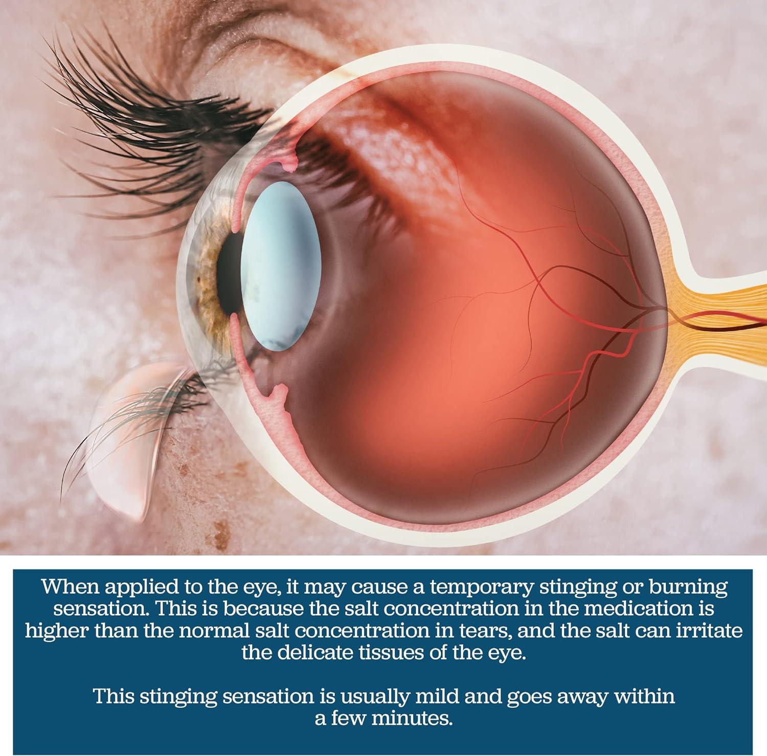 BASE LABORATORIES Corneal Edema Eye Ointment | 3% Sodium Chloride ...