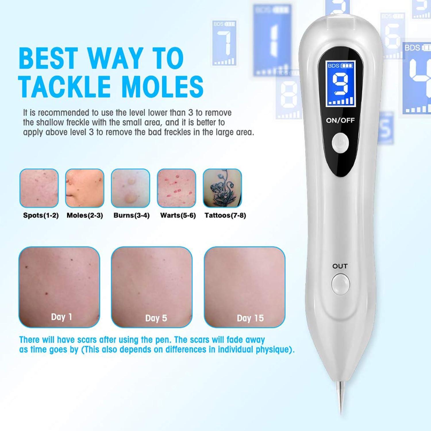 LARALA Skin Tag Removal Pen Skin Tag Removal Kit Mole Remover with 9 ...