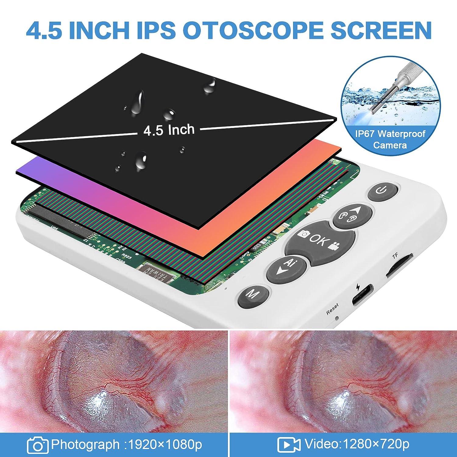 AI Intelligent Visual Digital Otoscope Hiacinto | Ear Wax Removal Tool ...