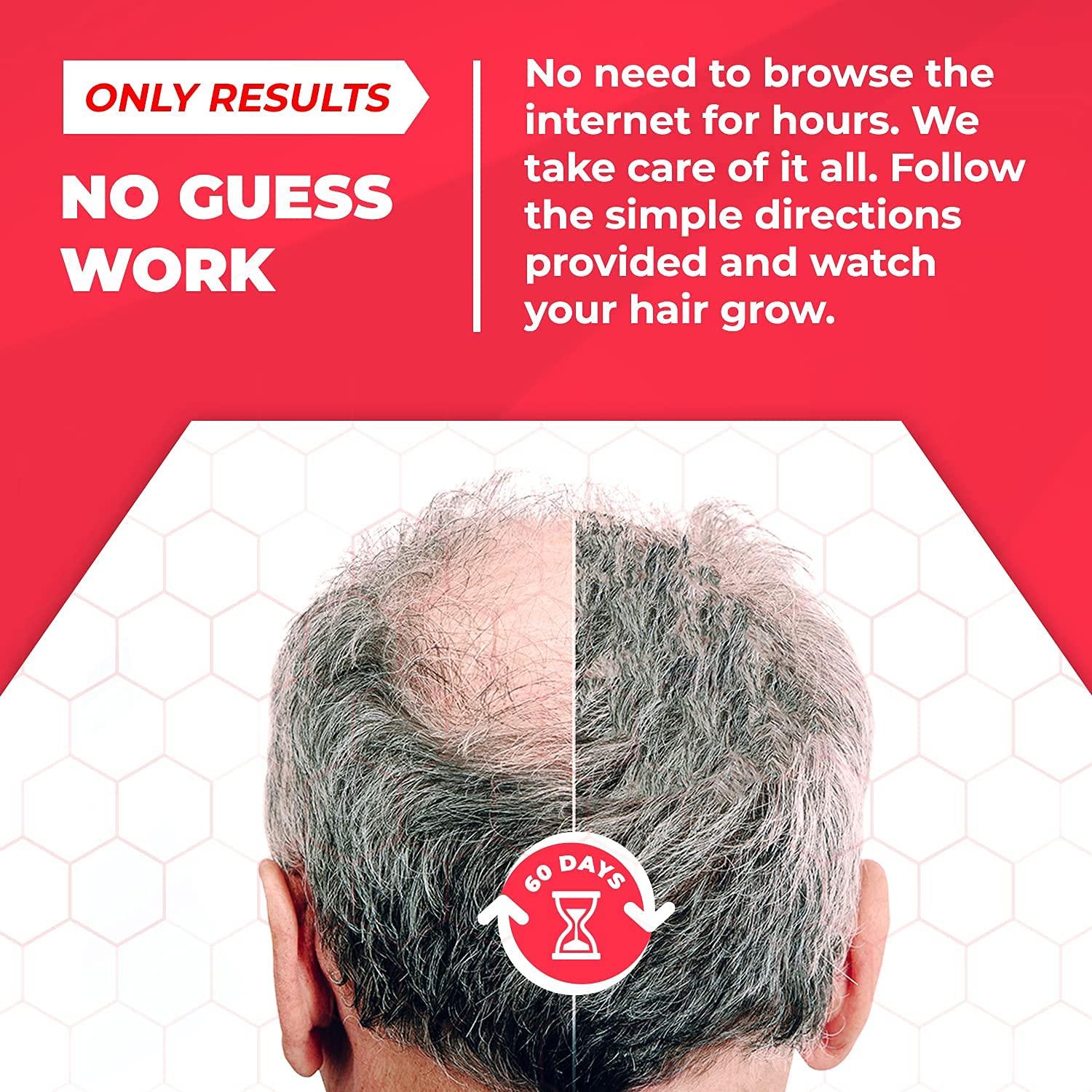 Regenivade Men's 5% Minoxidil Hair Regrowth Treatment - 3 Month Supply ...