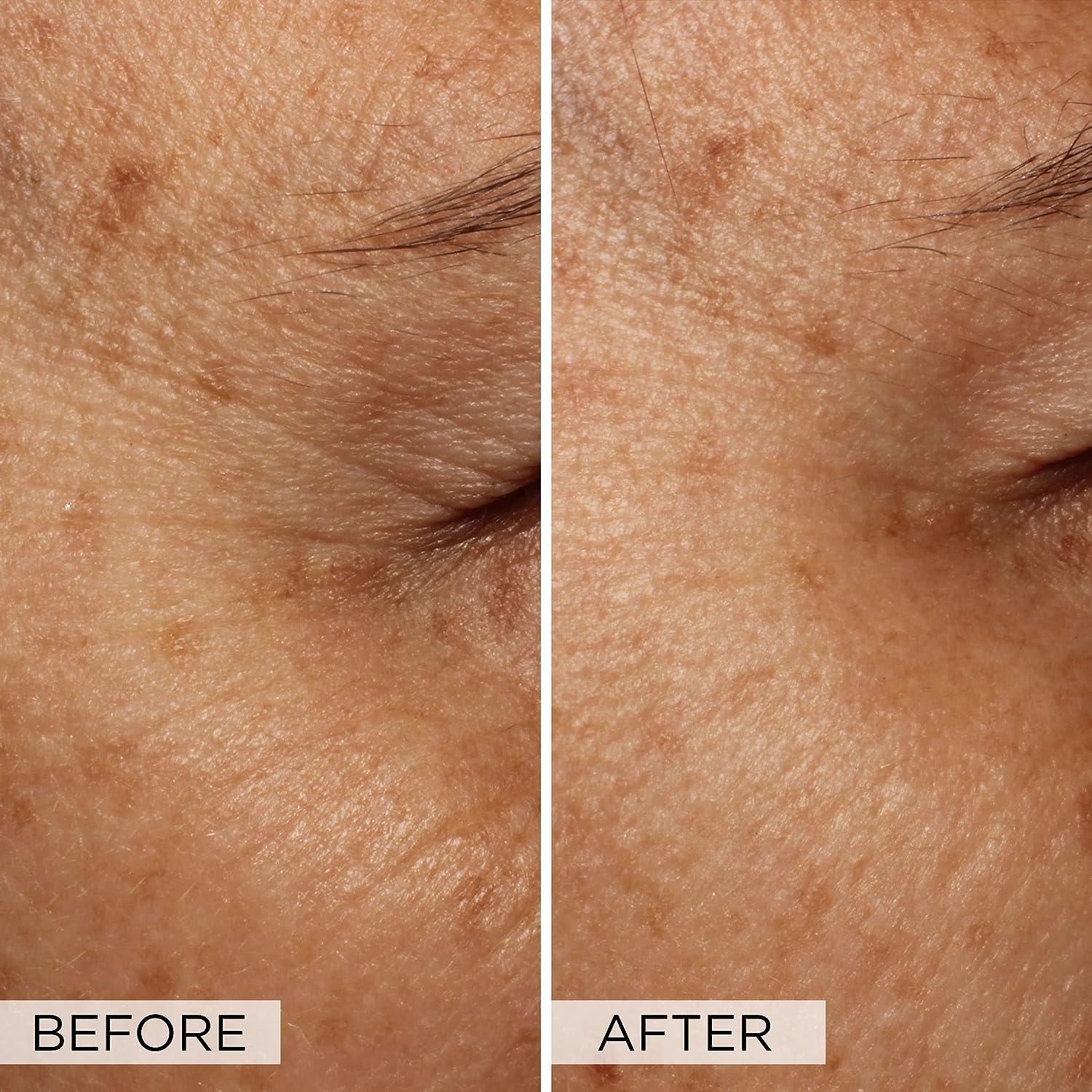 Dr. Brandt Needles No More Wrinkle Smoothing Cream - Lightweight Cream ...