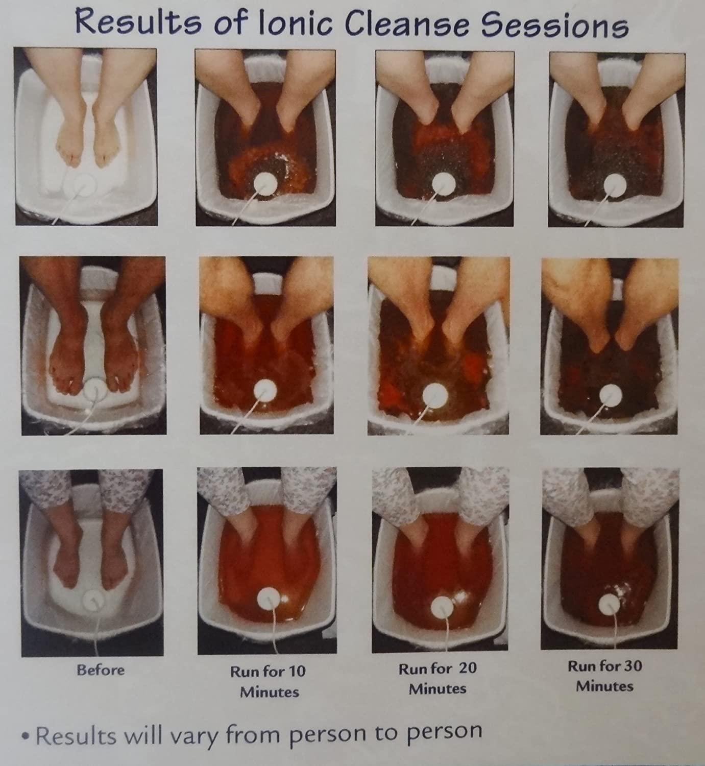 Ion Detox Ionic Foot Bath Spa Chi Cleanse Promotional Poster. 11 X 17 ...