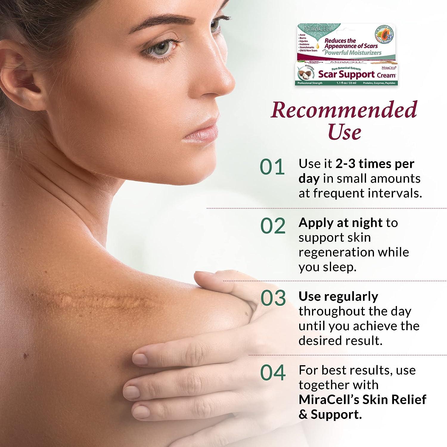 MiraCell Scar Support Cream - Natural Acne & Burn Scar Removal ...