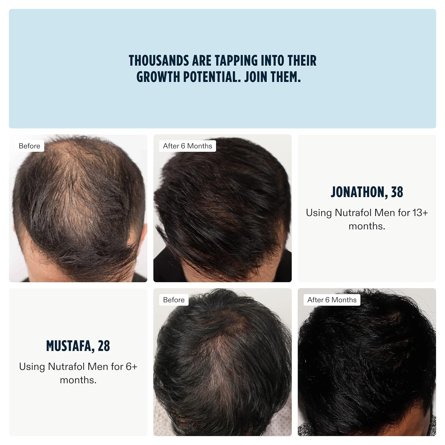 Nutrafol Men's Hair Growth Supplements - Clinically Tested for Thicker ...