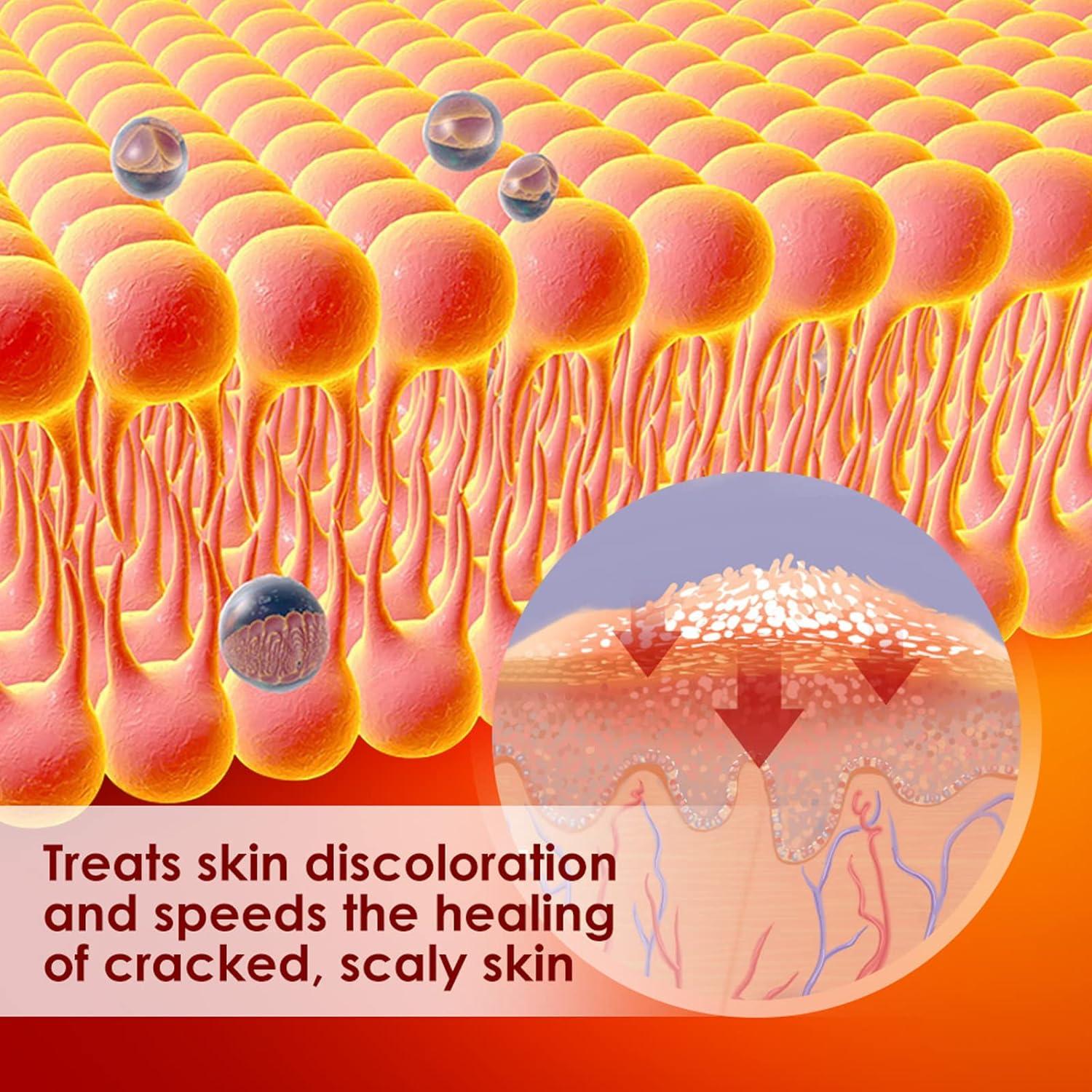 Natural Itching Cream Relieve Itchy Skin For Dry Irritated Skin Rashes