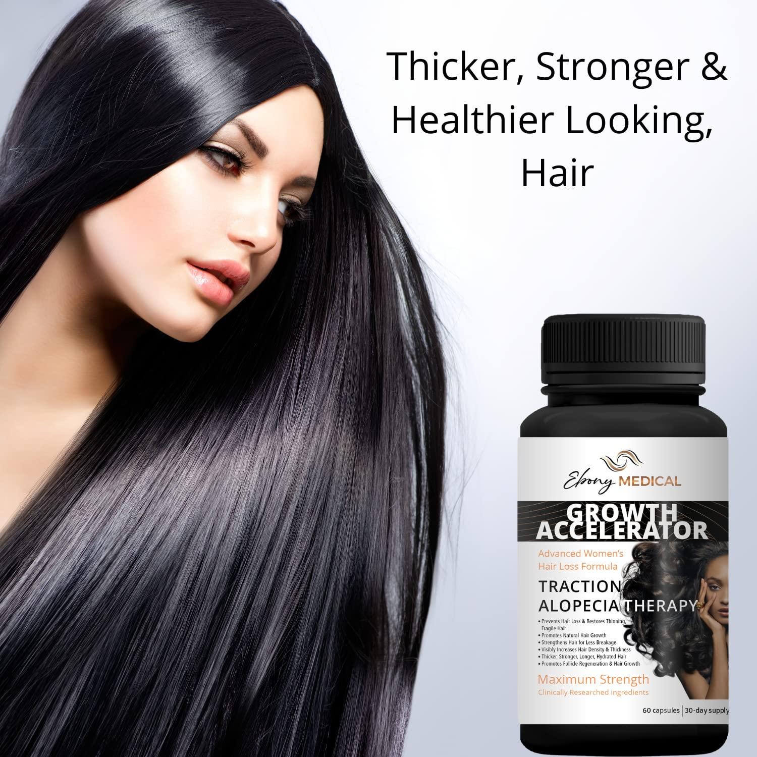 Hair Regrowth Supplement for Alopecia - Vegan Capsules for Thicker ...