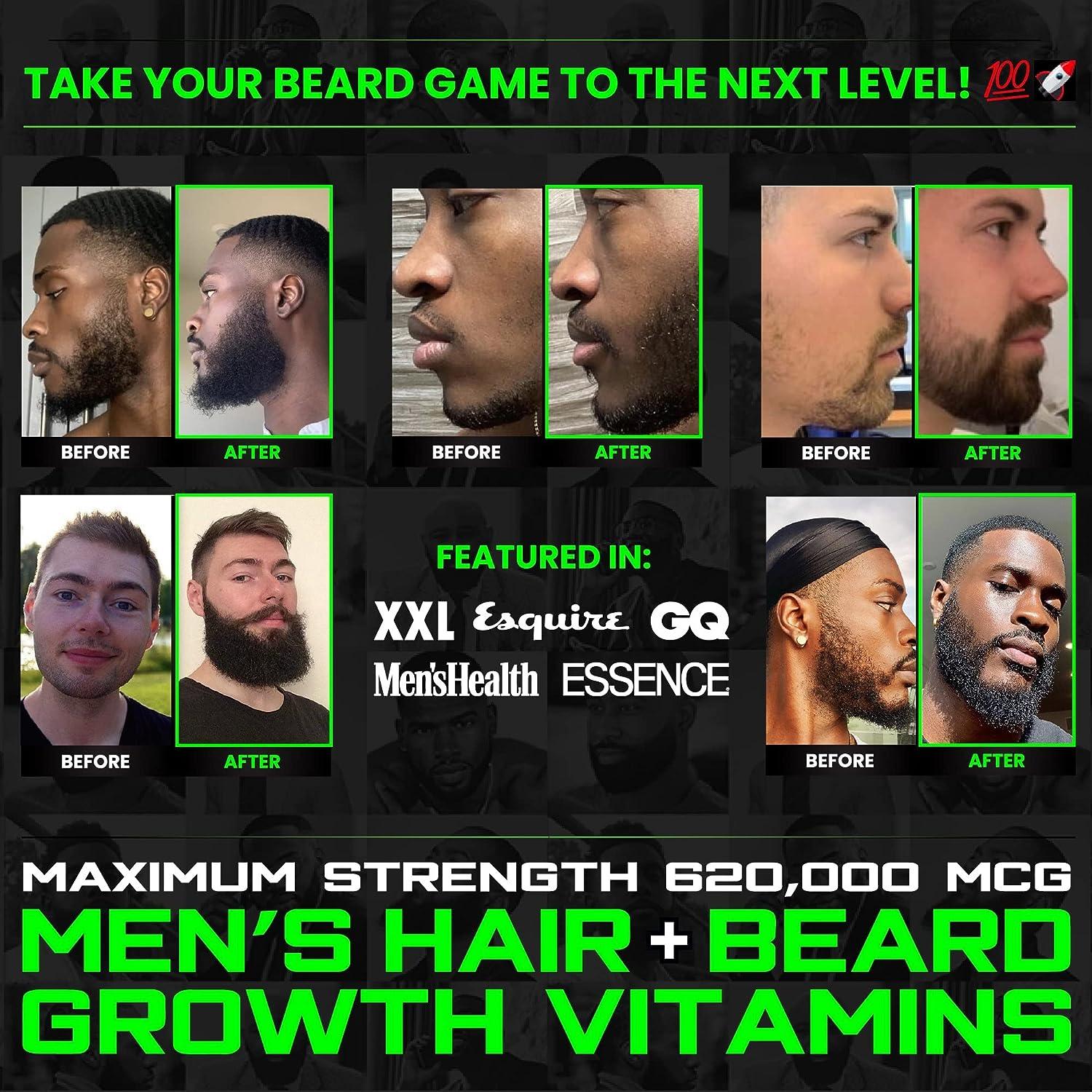BBS Beard & Hair Growth Vitamins for Men - Maximum Strength 620000mcg ...