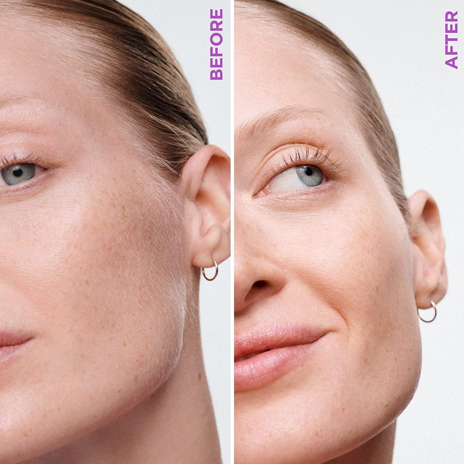 Schick Hydro Silk Dermaplaning Wand with 6 Refill Blades - Professional ...