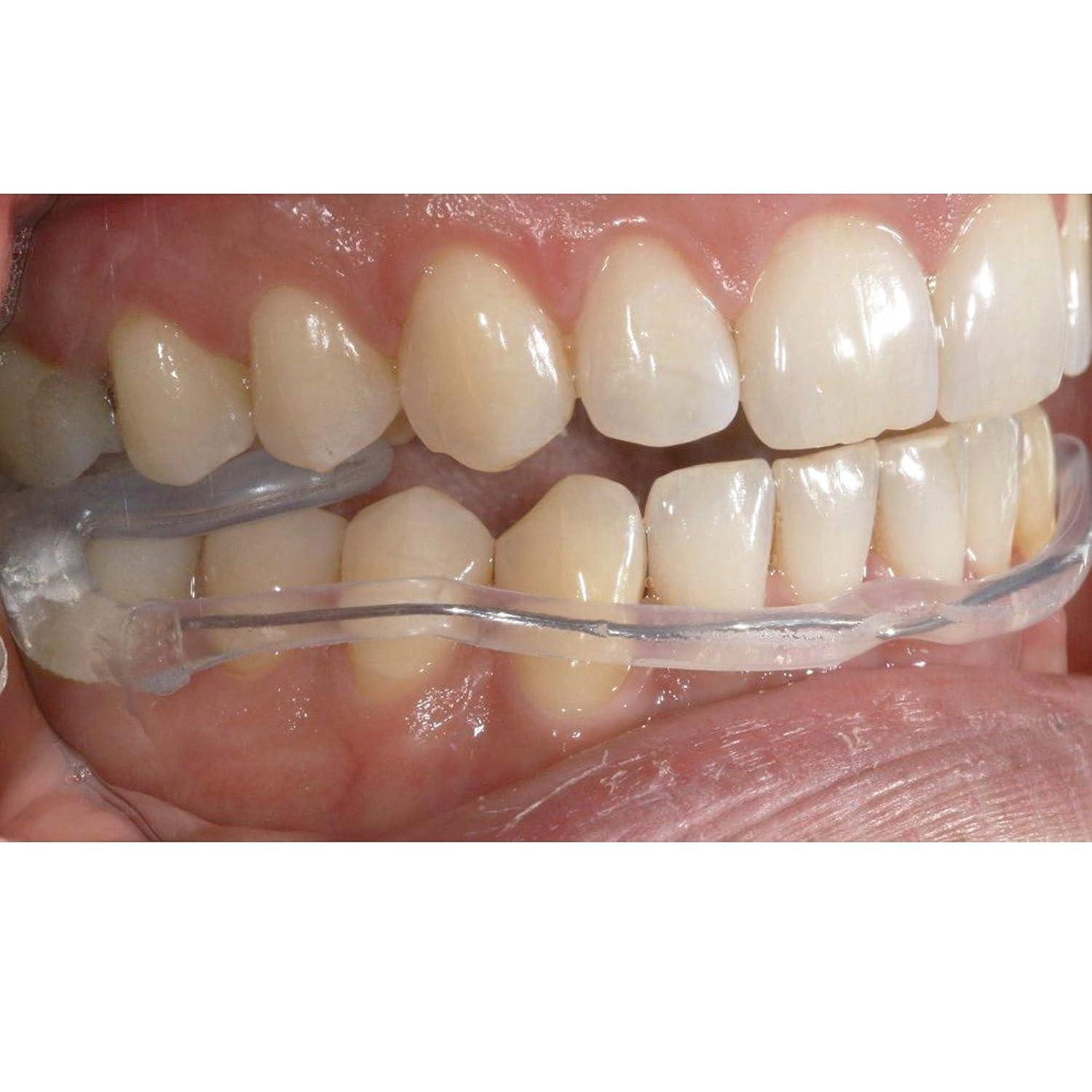 AquaSplint Mini: Self-Adjusting Water-Filled Bite Splint for CMD Relief ...