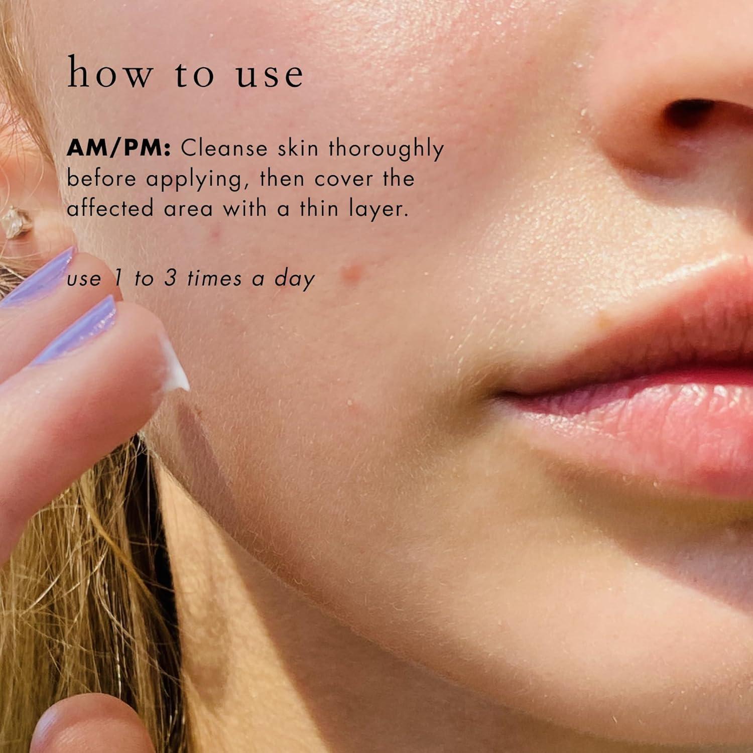 Bioelements Breakout Control - 5% Benzoyl Peroxide Acne Spot Treatment ...