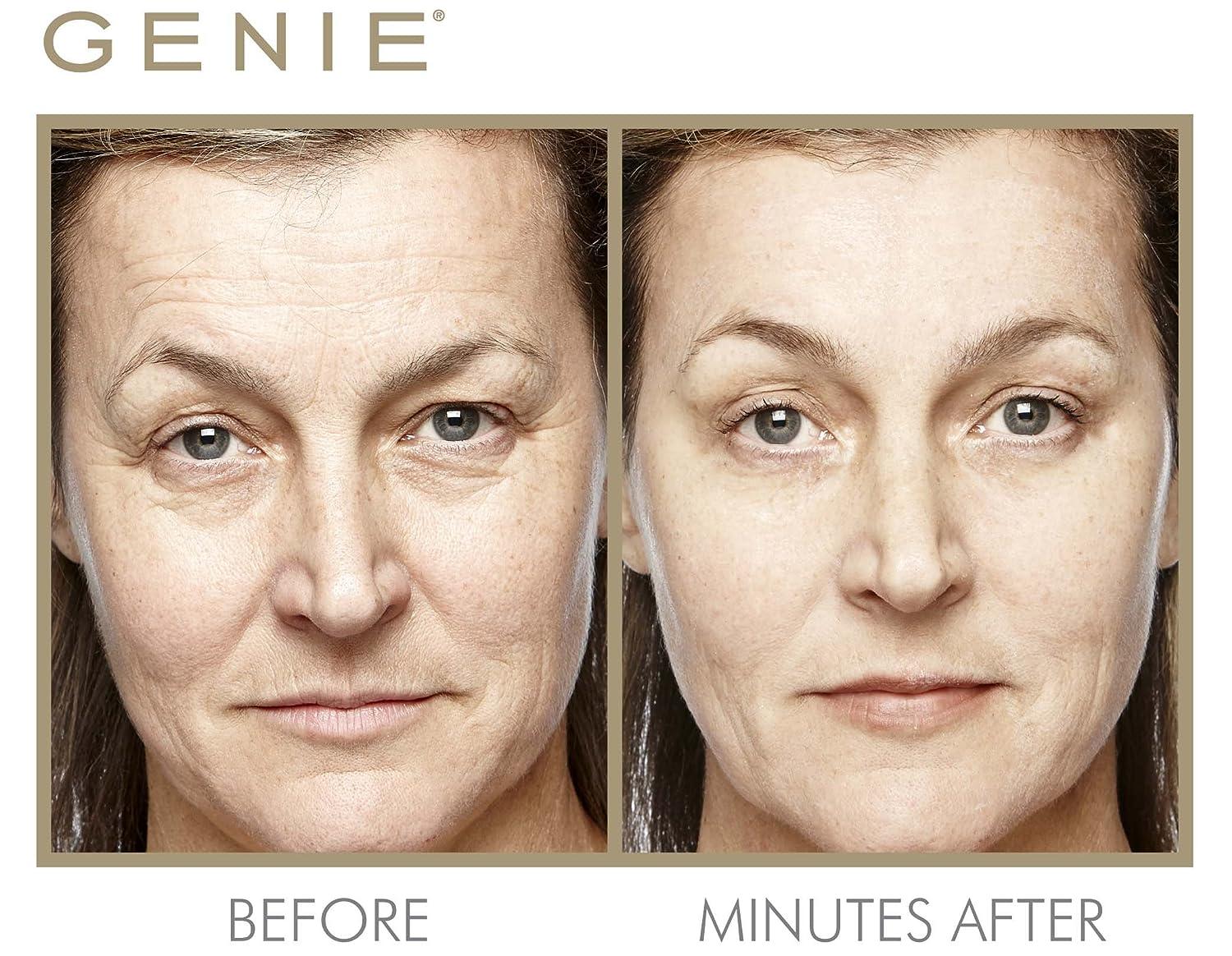 Genie Instant Line Smoother - Anti-Aging Serum (19 ml) | Instant ...